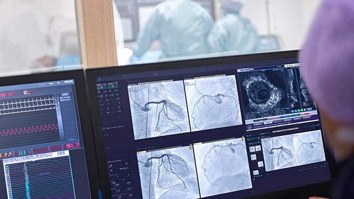 Programas de entrenamiento - Terapia Guiada Por Imagen | Philips Healthcare