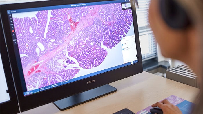 Digital pathology | Philips Healthcare