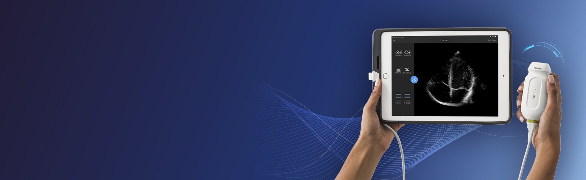 Philips & FIMMG Lumify | Philips