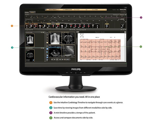 Cardiovascular Information Systems | Clinical Informatics | Philips ...