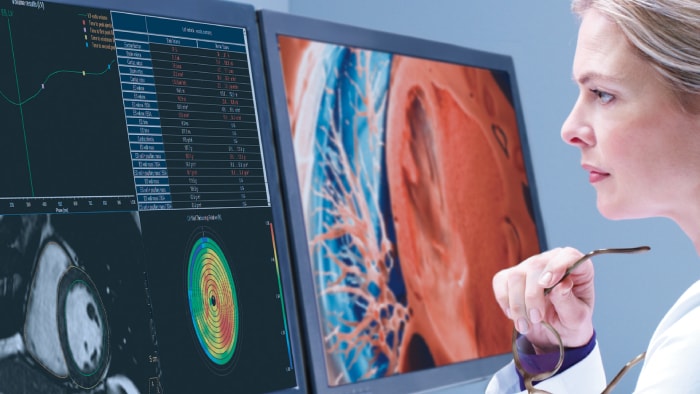 Solution de post-traitement Philips IntelliSpace Portal 12 pour centres d'imagerie | Philips ...