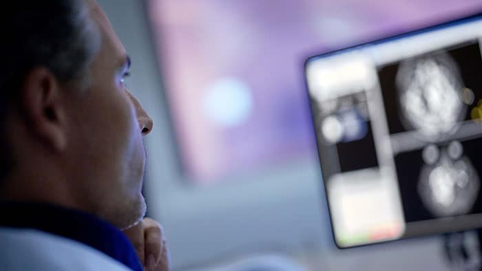 RM Compressed SENSE | Philips