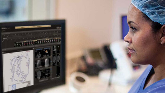 Cardiologie-informatica | Philips
