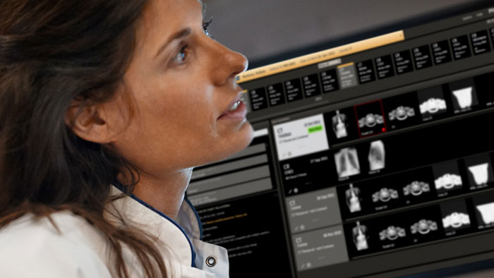 Enterprise imaging data interoperablity for improved performance | Philips