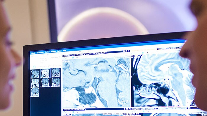 Naadloze radiologieoplossingen | Philips