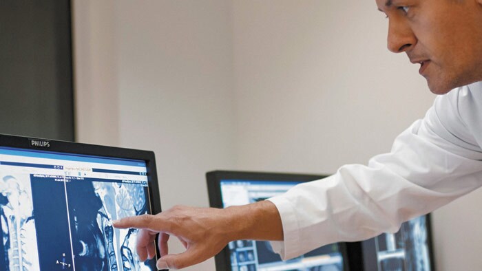 Lesion detection and quantification | Philips Healthcare