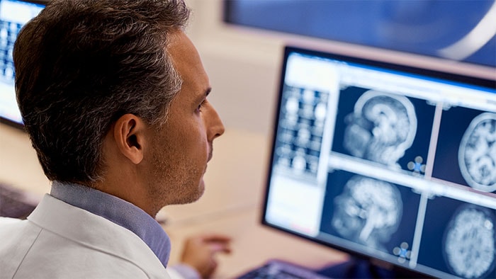 Intraoperative MRI enhances precision | FieldStrength | Philips