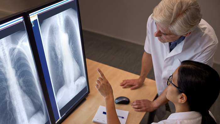 Chest Optimization | Philips