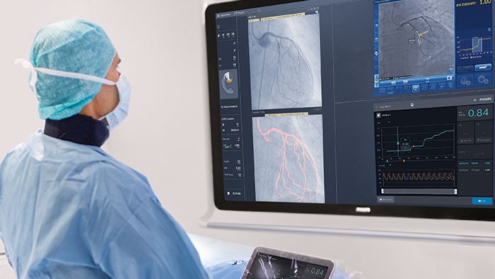 Guía de presión Omniwire | Terapia guiada por imagen | Philips Healthcare