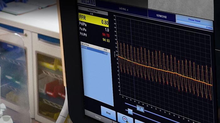 Réserve de débit fractionnaire (FFR) | Philips Healthcare