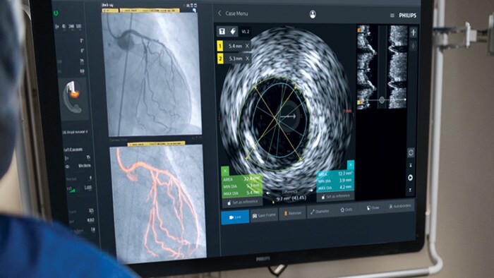 IVUS Image Interpretation - Coronary IVUS | Philips Healthcare