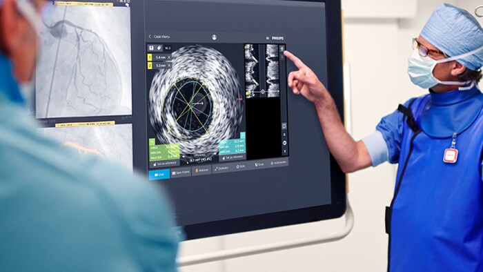 Ivus Intravascular Ultrasound Philips