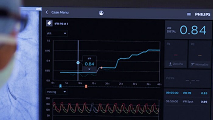 Coronary Physiology Modalities: iFR and FFR | Philips