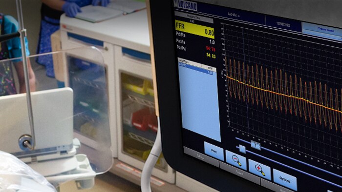 Метод определения ФРК - измерение фракционного резерва кровотока ...