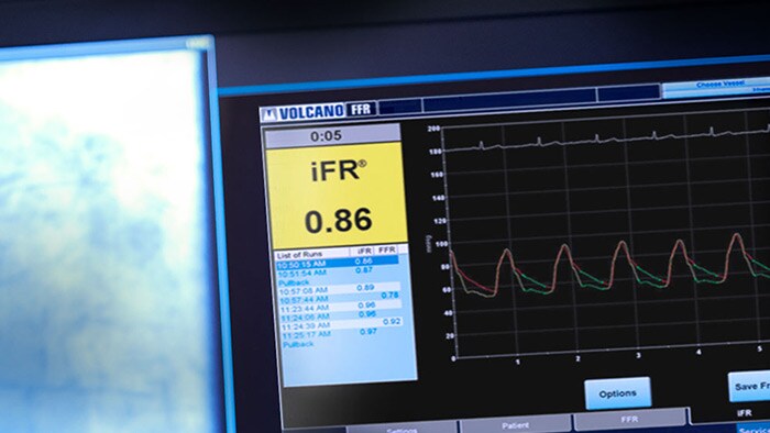 iFR (instant wave-Free Ratio) | Philips Healthcare