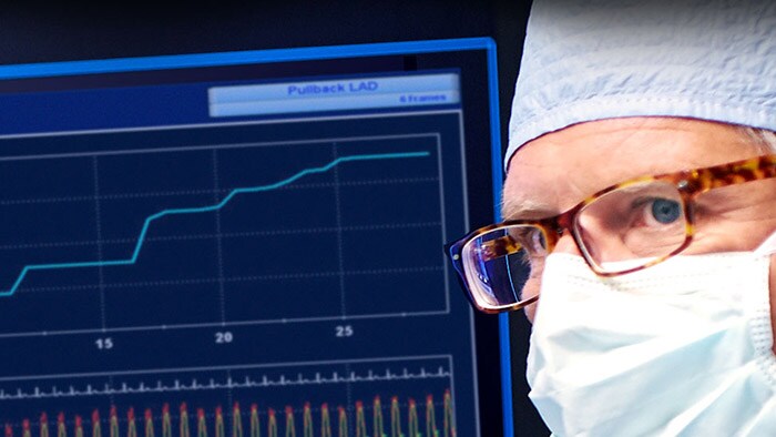 iFR Scout | Philips Healthcare