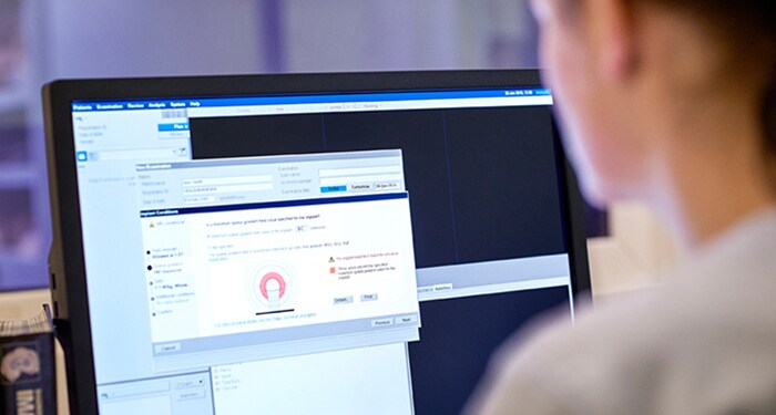 ScanWise Implant | Philips