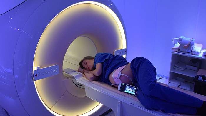 Fetal cardiac MR with ultrasound gating - FieldStrength | Philips
