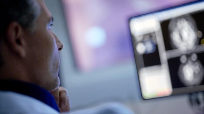 How Compressed SENSE Makes MRI faster | FieldStrength | Philips