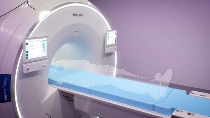 RM Ingenia Elition 3.0T | Philips