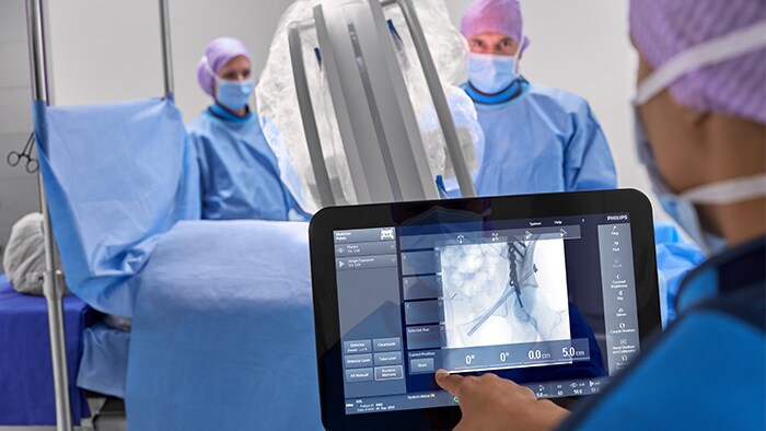 Mobile C-arms for Orthopedics | Philips