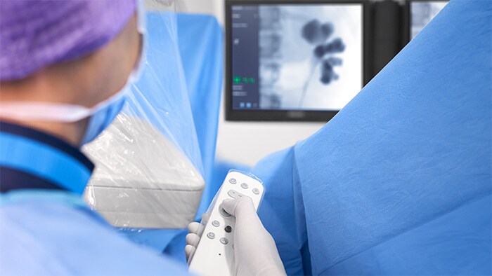 Mobile C-arm for Gastroenterology - Urology | Philips