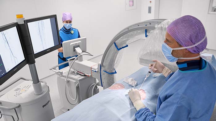 Mobile C-arms for Vascular | Philips