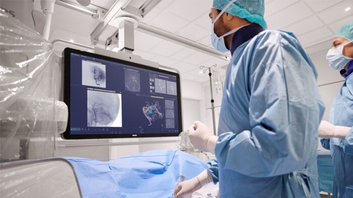 AVM treatment | Philips