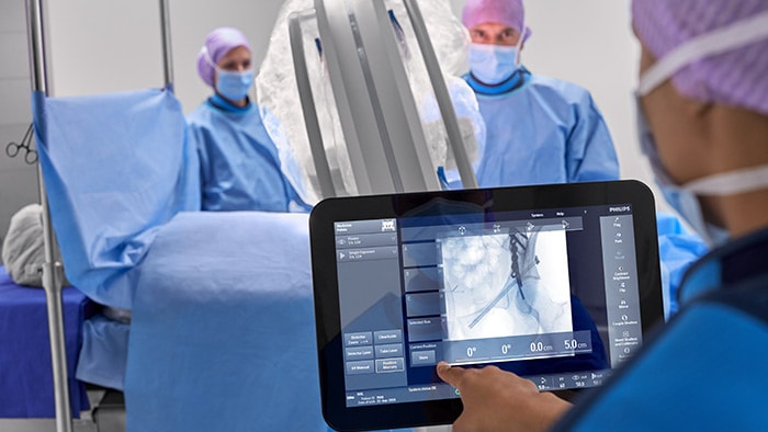 Philips Zenition - Mobile C-Arms | Philips