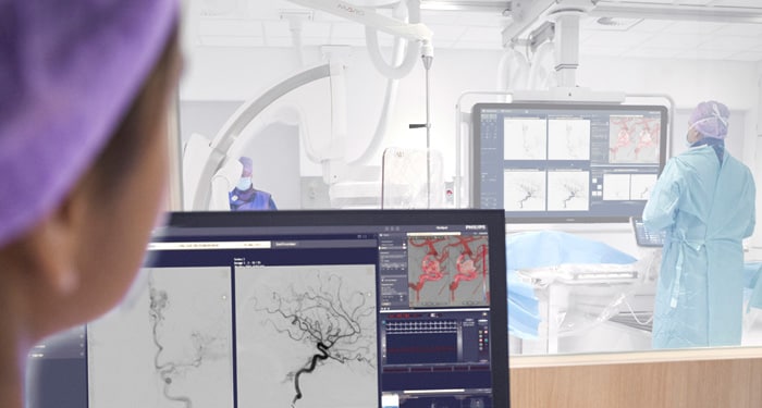 Neuro suite | Image guided therapy | Philips Healthcare