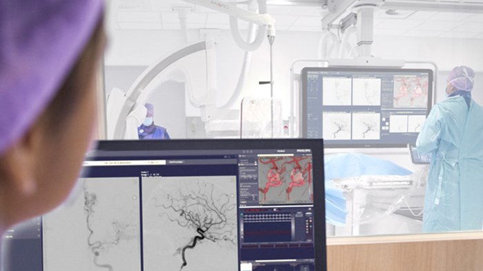 Neuro Suite - Terapia guiada por imágenes | Philips Healthcare