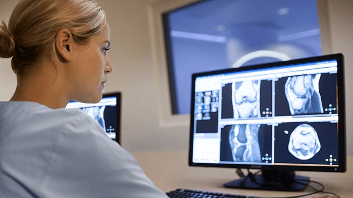 Технология Compressed SENSE разработана Philips для быстрого и ...