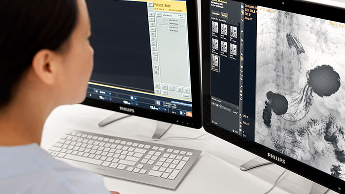 Philips Dynamic UNIQUE | Philips