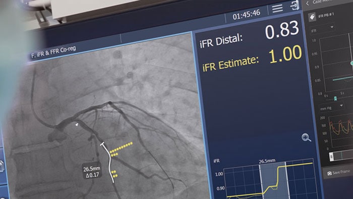 iFR modality | Philips