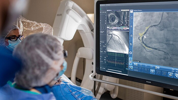 iFR and FFR help to guide PCI | Philips Healthcare