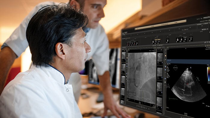 IntelliSpace Cardiovascular | Philips Healthcare
