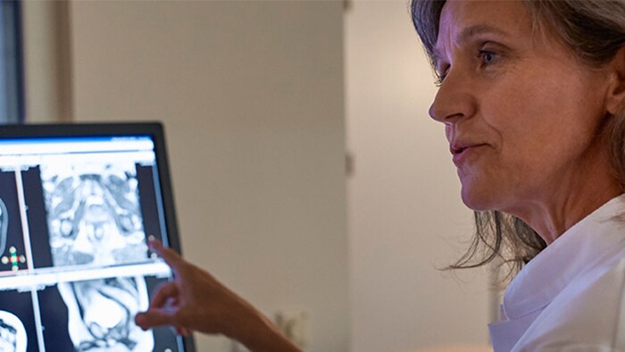 MRI in RT - a new vision for radiotherapy | Philips Healthcare