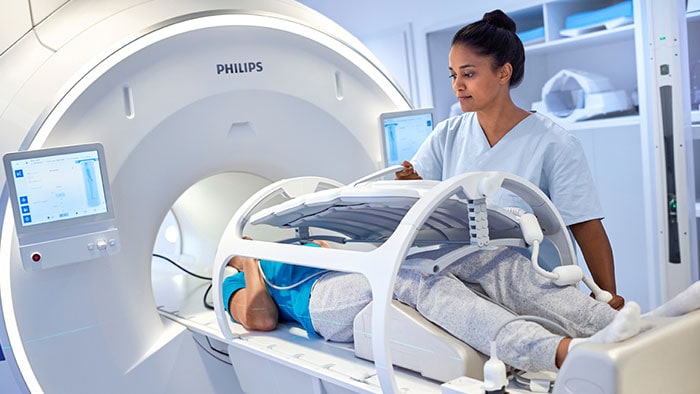 MRI in RT - a new vision for radiotherapy | Philips