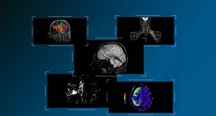 MR Neuro Imaging | Philips
