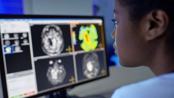 MR Neuro imaging | Philips Healthcare