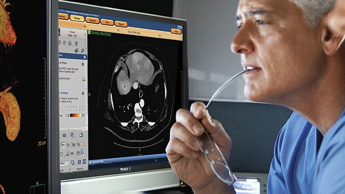 Spectral Detector CT | Philips Healthcare