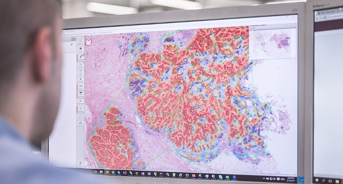 What is computational pathology | Philips Healthcare