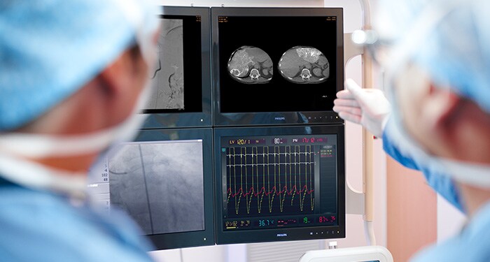 Interventional X-ray | HotSpot | Philips Healthcare