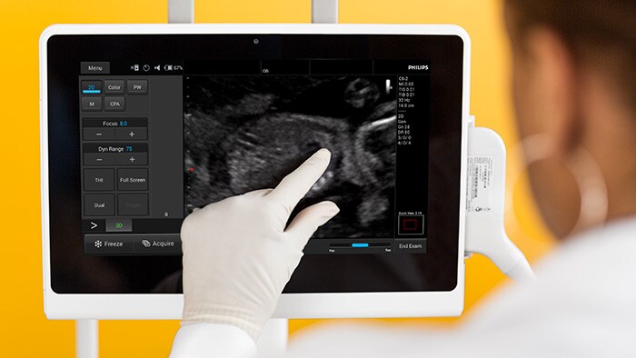 Innosight tutorial videos | Philips Healthcare