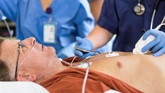 Bedside Ultrasound in the ED | Philips