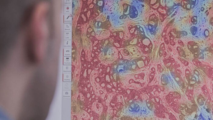What is computational pathology? | Philips Healthcare