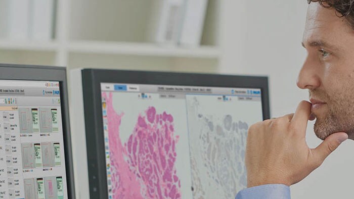 Philips Digital & Computational Pathology | Philips