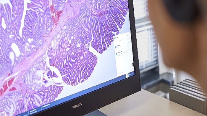 Philips IntelliSite Pathology Solution | Philips