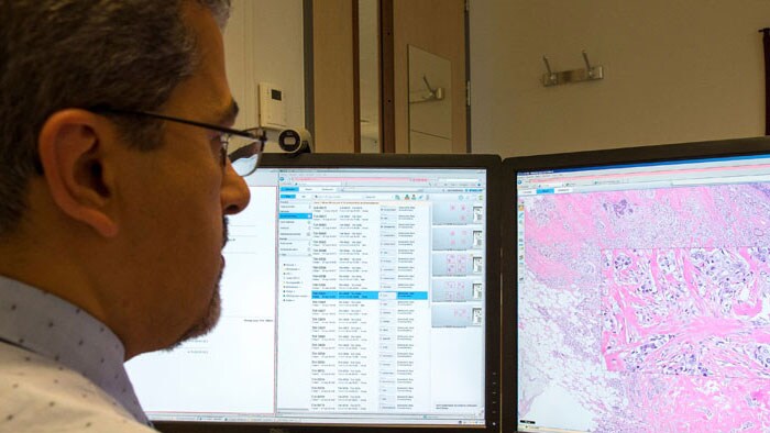 Philips IntelliSite Pathology Solution | Philips Healthcare