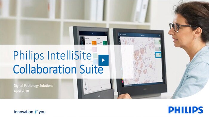 Watch webinar: Philips IntelliSite Collaboration Suite | Philips Healthcare